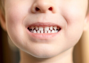 All About Primary Teeth (And Why They're Important)