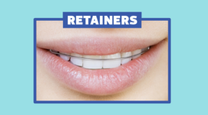 Retainers for Kids Teeth in San Diego | The Super Dentists